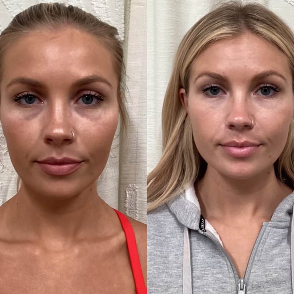 Anti-Aging, Botox, PDO Thread Lift, Vampire Facials, StemCell Therapy ...